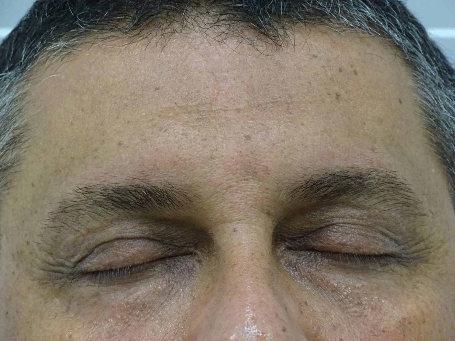 Facial treatments: skin care through icoone®